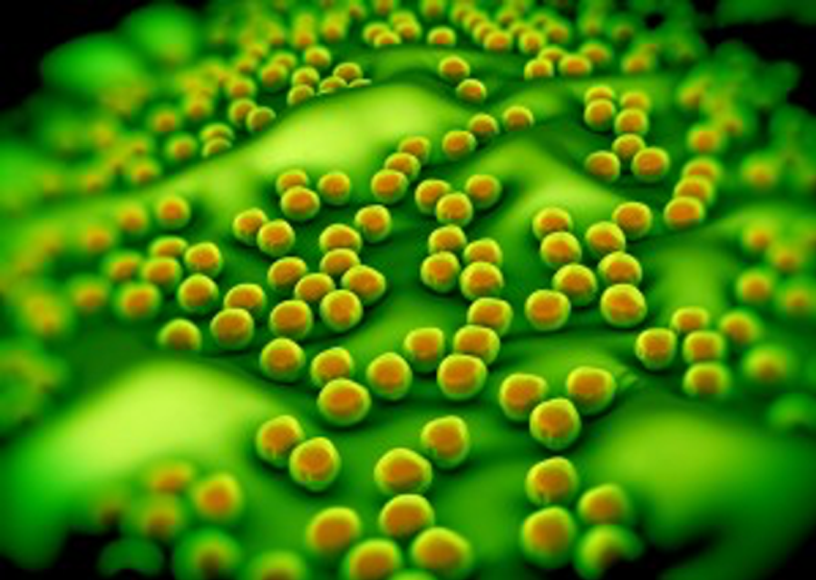 Bacteria-Staph-Staphylococcus-Aureus- – Safe Air Home